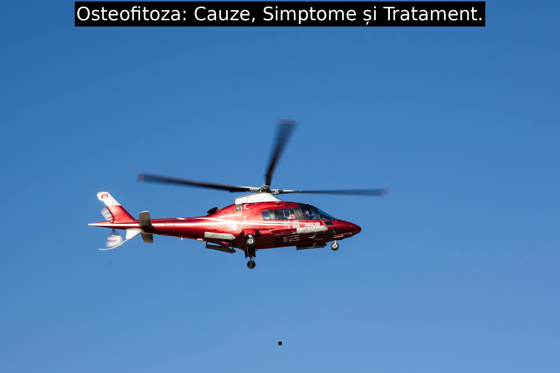 Osteofitoza: Cauze, Simptome și Tratament. - Medicina Sportiva